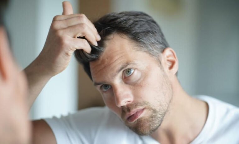 Haarausfall Männer: So stoppst Du ihn zuverlässig